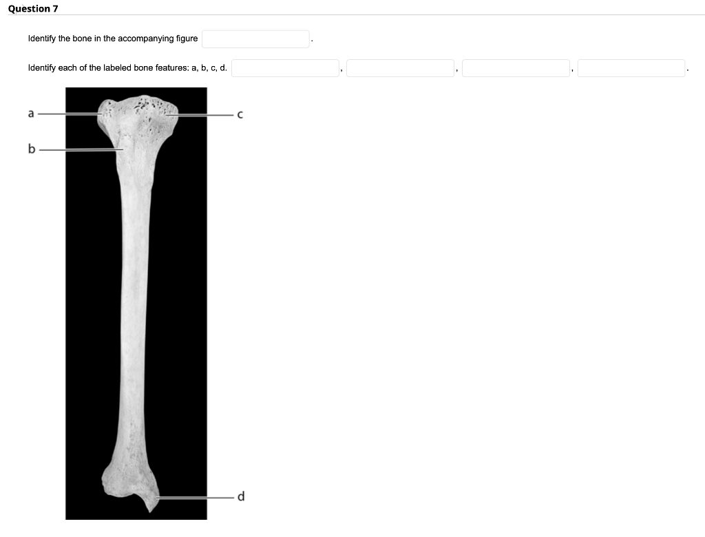 Solved Question 2 10 Identify the bone in the accompanying | Chegg.com