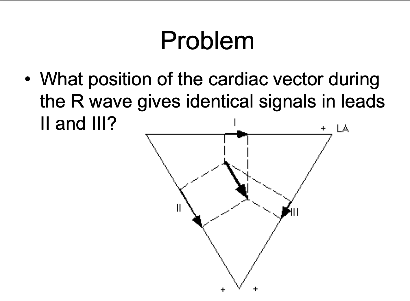 Solved - What position of the cardiac vector during the R | Chegg.com