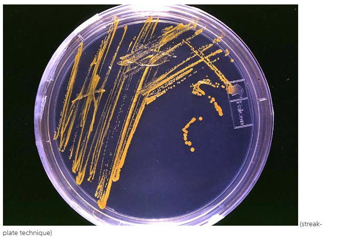 Solved ENVIRONMENTAL SPECIMEN Spread-Plate Technique | Chegg.com