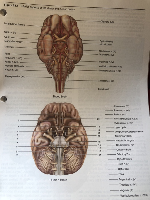 Mammillary Bodies Sheep Brain
