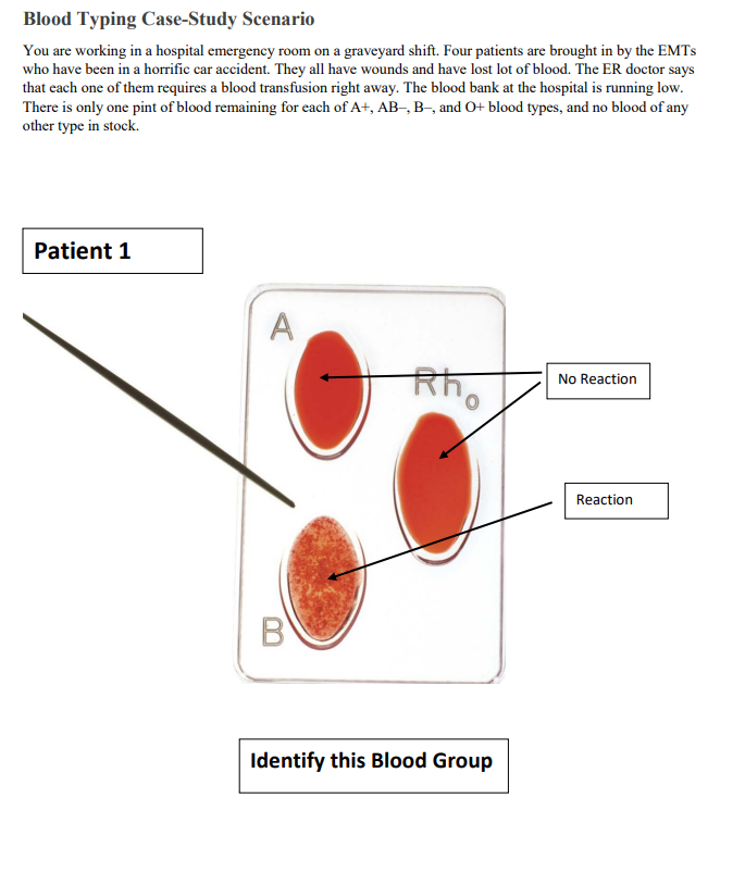 Solved Blood Typing Case-Study Scenario You are working in a | Chegg.com
