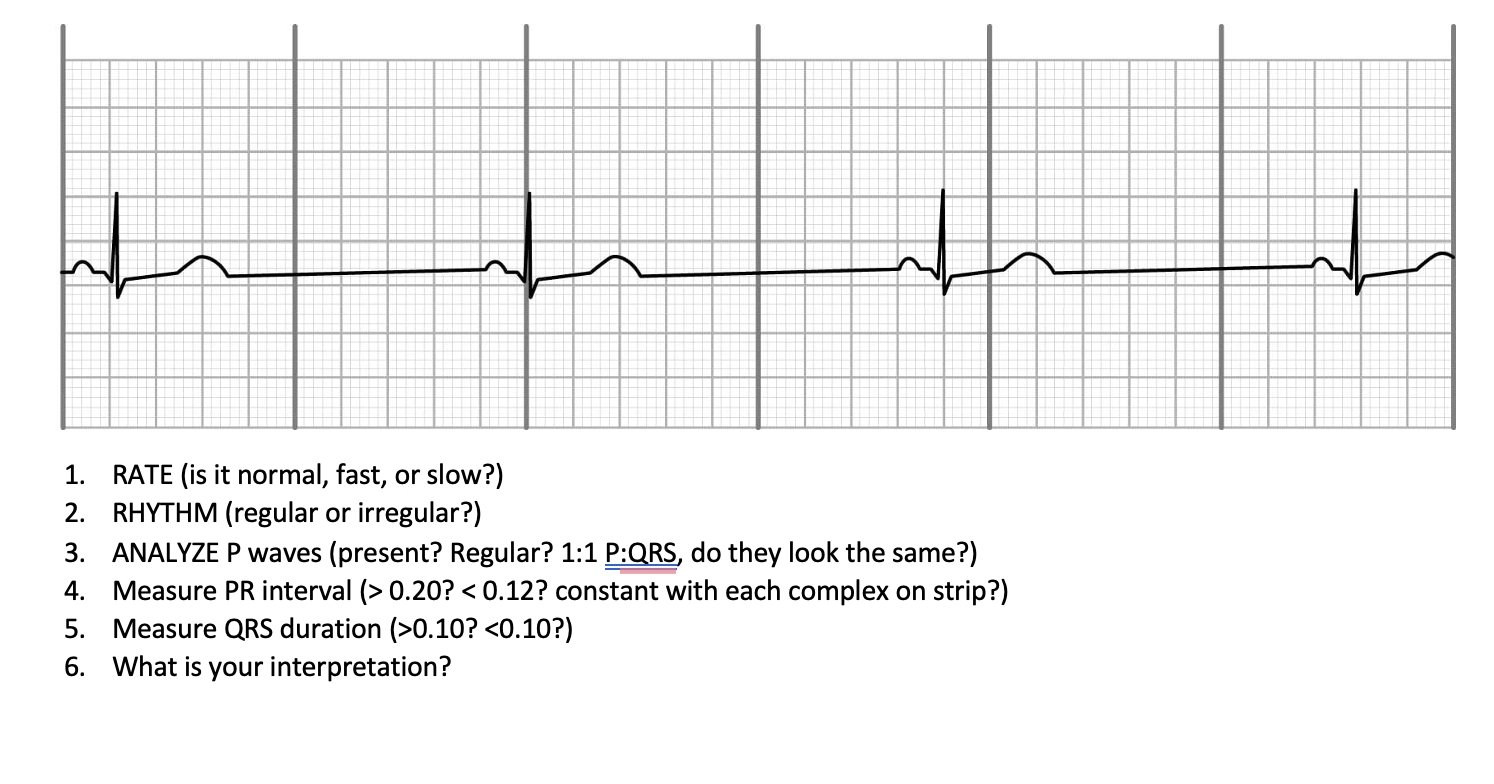 Solved 1. RATE (is it normal, fast, or slow?) 2. RHYTHM | Chegg.com