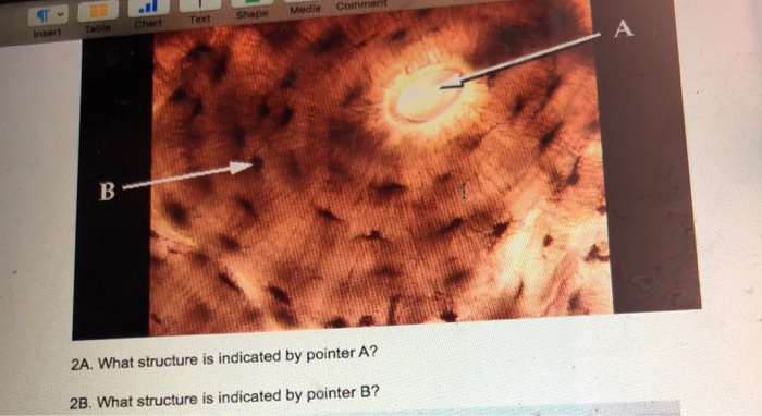 Solved 2A. What structure is indicated by pointer A? 2B. | Chegg.com