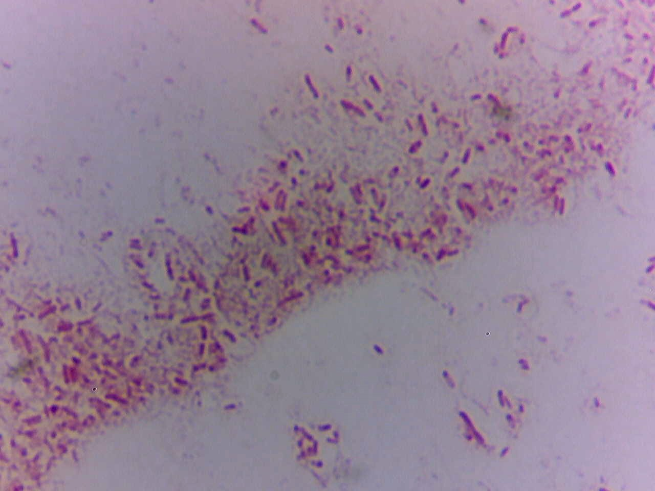 Solved =2)=The following Gram stain was made from a | Chegg.com