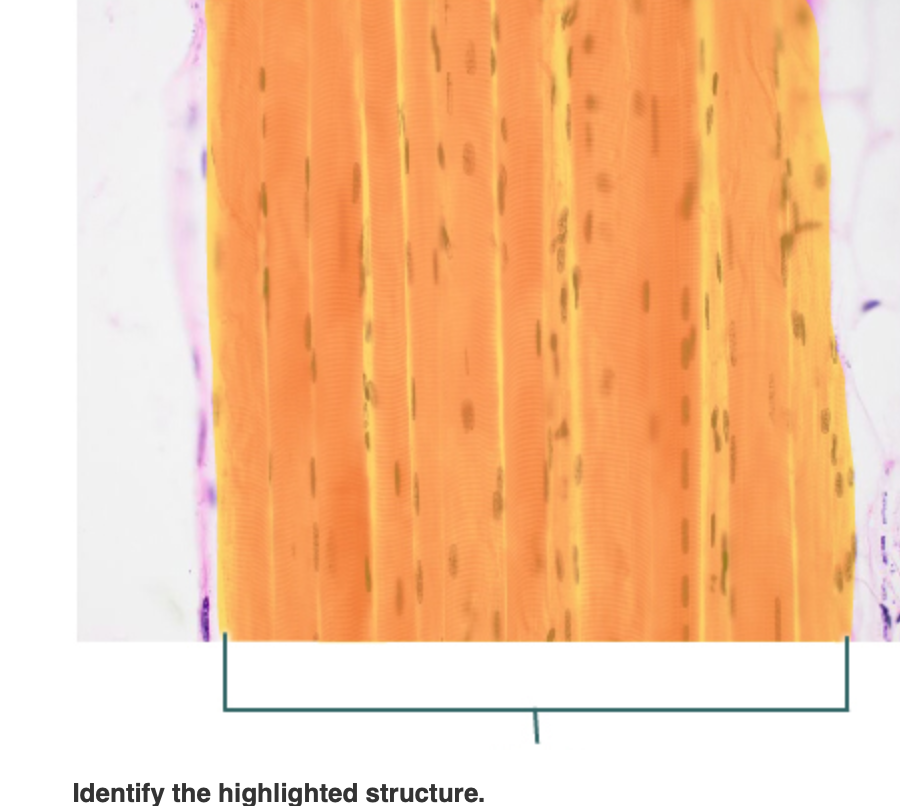 Solved Identify the highlighted structure. | Chegg.com Solved Identify the highlighted structure. | Chegg.com