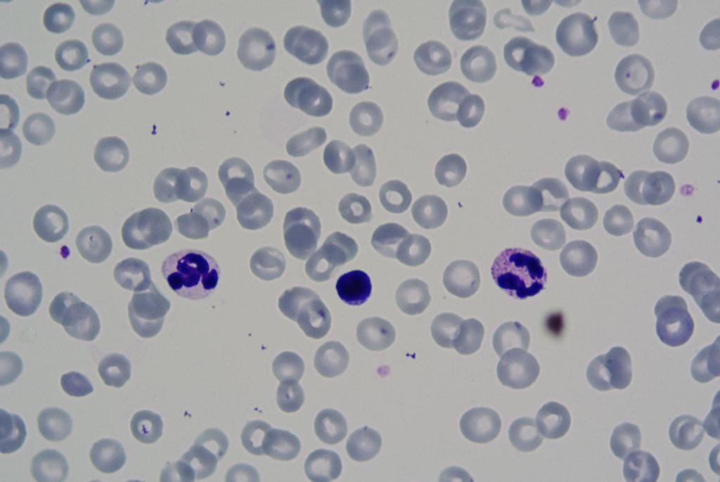 Solved execute the following code on matlab for the | Chegg.com