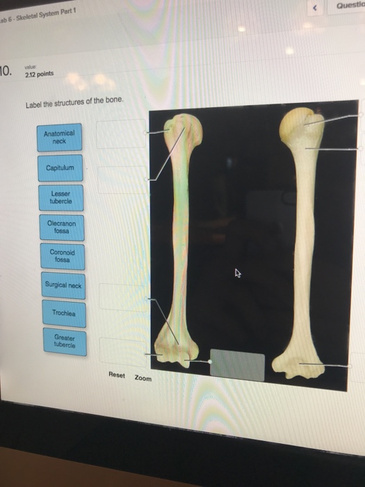 Solved Questio ab 6-Skeletal System Part 1 2.12 points Label | Chegg.com