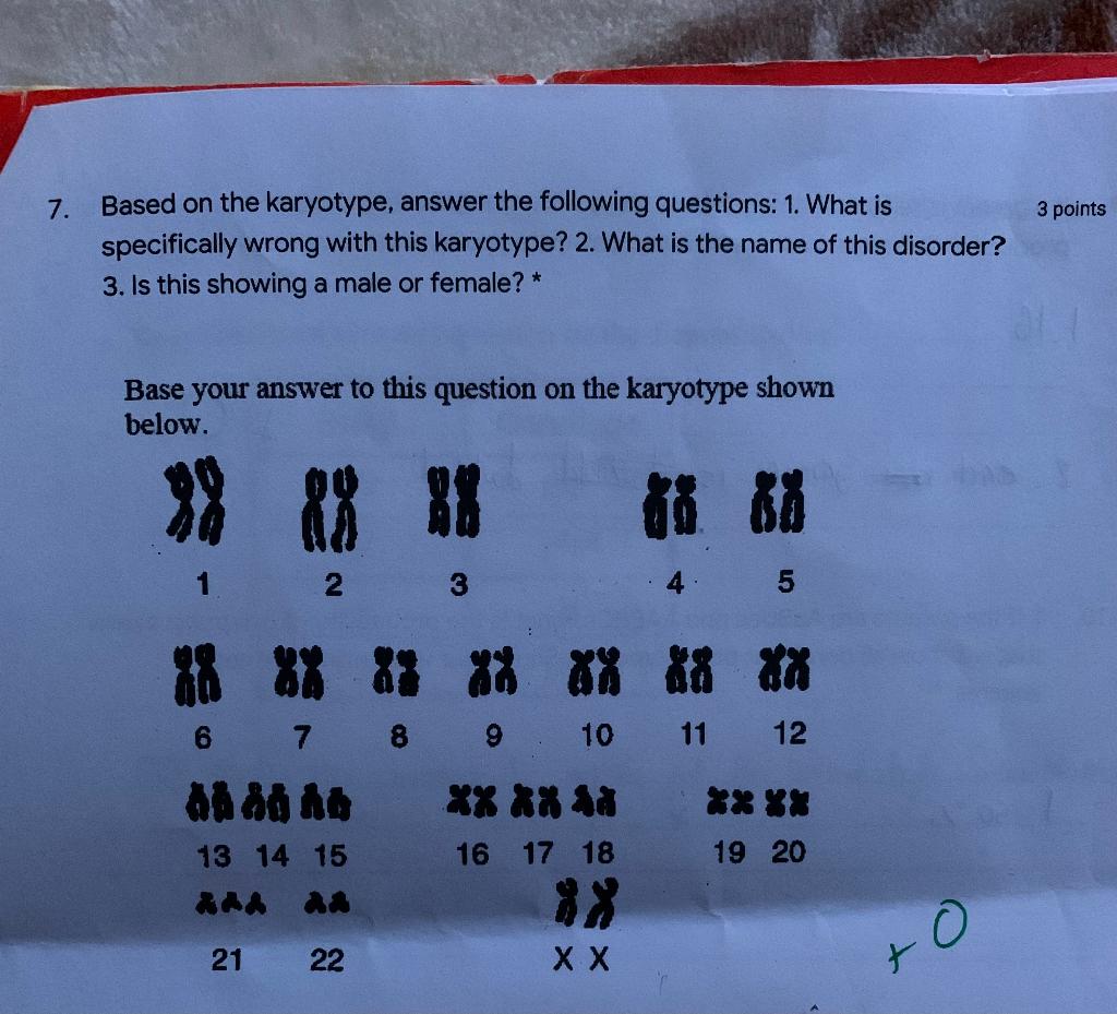 Solved 7. 3 points Based on the karyotype, answer the | Chegg.com