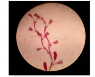 Solved 11 points The colonial polyp structure of the Obelia | Chegg.com