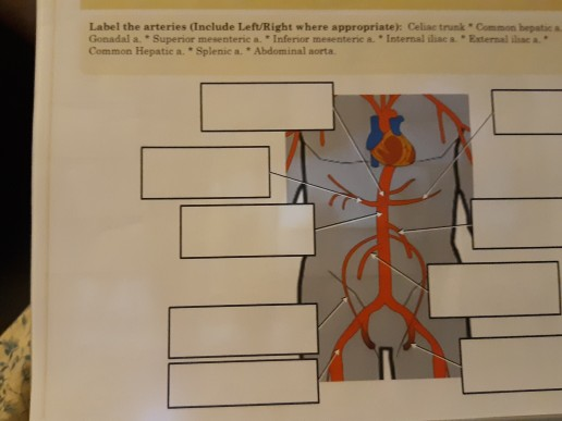 Solved Label the following arteries (Include Left/Right | Chegg.com