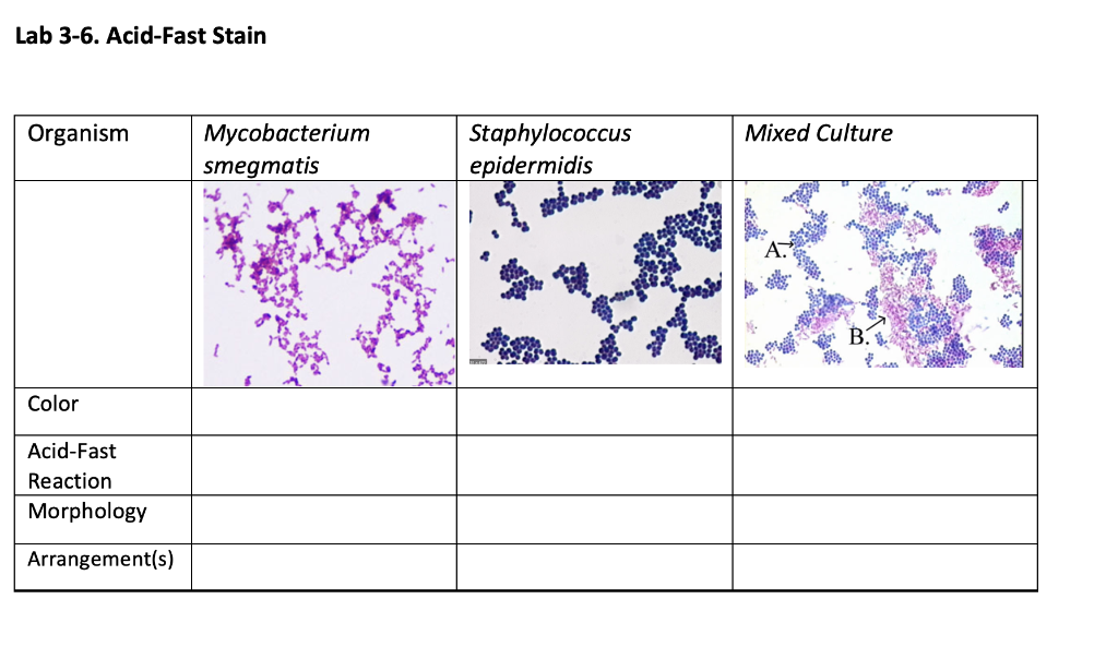 Acid-Fast Stain- Principle, Procedure, Interpretation And, 50% OFF