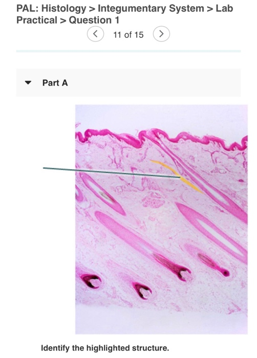 Solved PAL: Histology >Nervous Tissue > Lalb Practical | Chegg.com