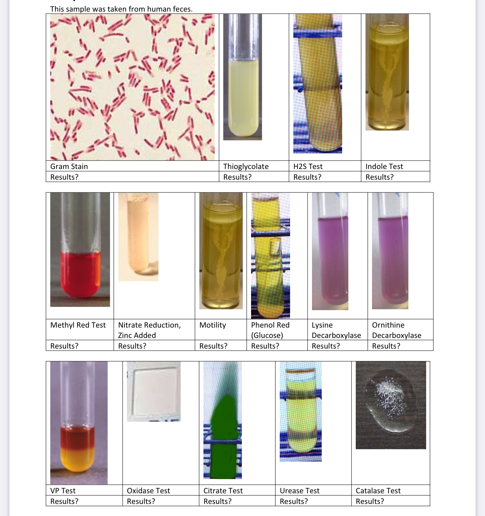 This sample was taken from human feces. | Chegg.com