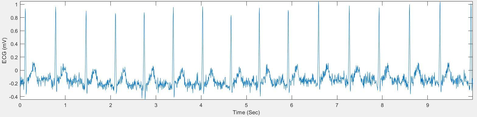 The heart record or ECG is one of the most important | Chegg.com