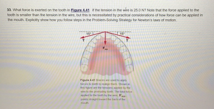 Solved 33. What force is exerted on the tooth in Figure 4.41 | Chegg.com