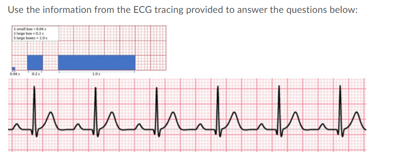 Solved Use the information from the ECG tracing provided to | Chegg.com