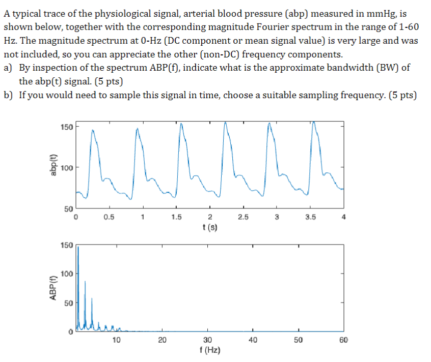 A typical trace of the physiological signal, arterial | Chegg.com