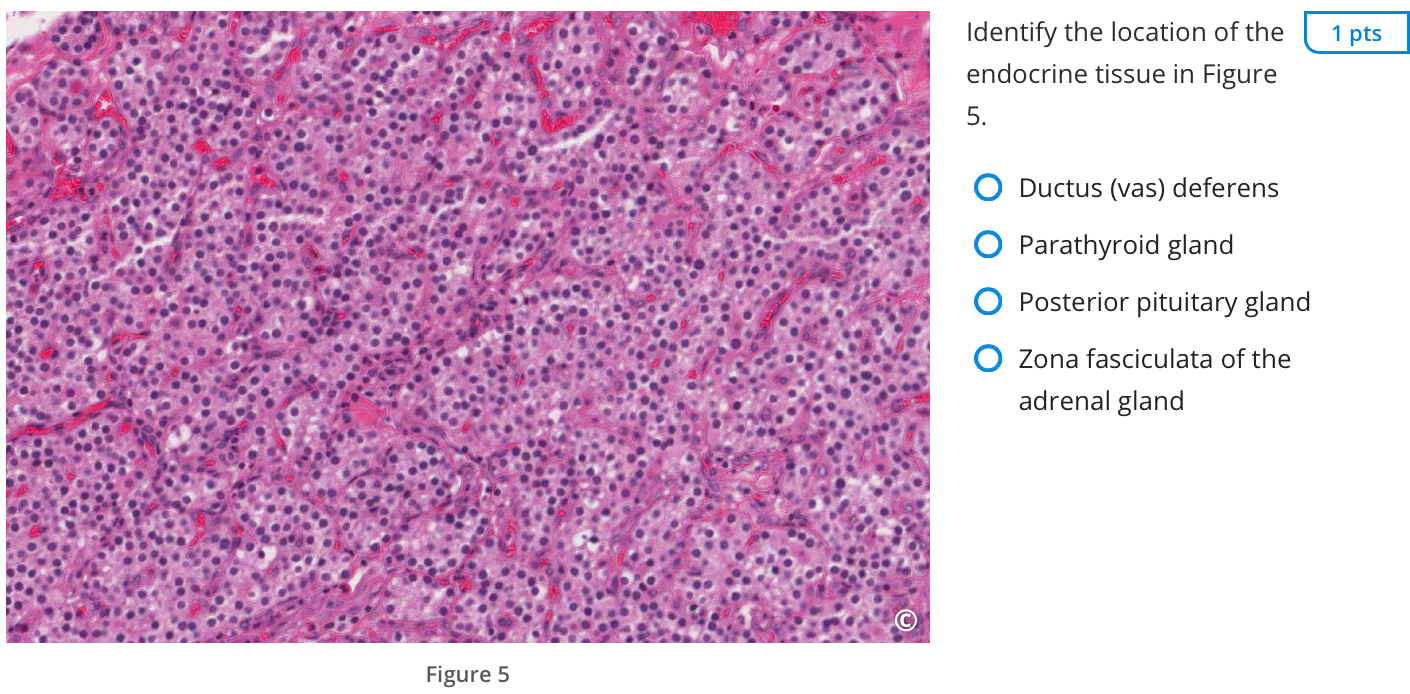 Solved 1 pts Identify the location of the endocrine tissue | Chegg.com