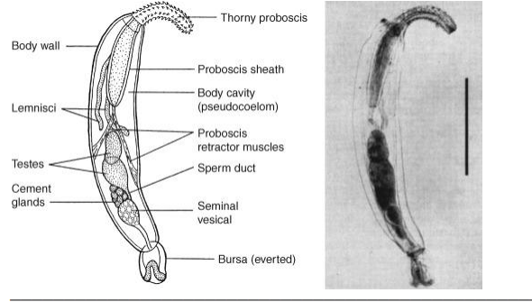 Solved 1) Is this image a representative of Acanthocephalan? | Chegg.com