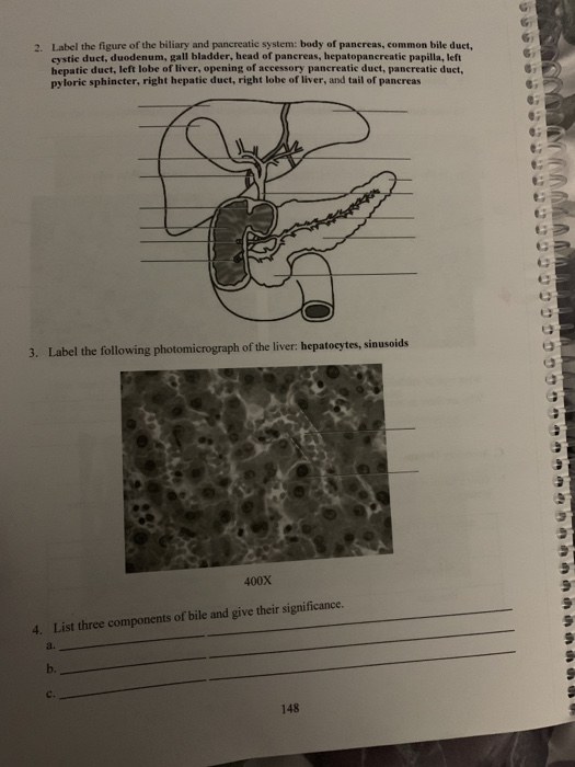 Solved Label the figure of the biliary and pancreatic | Chegg.com