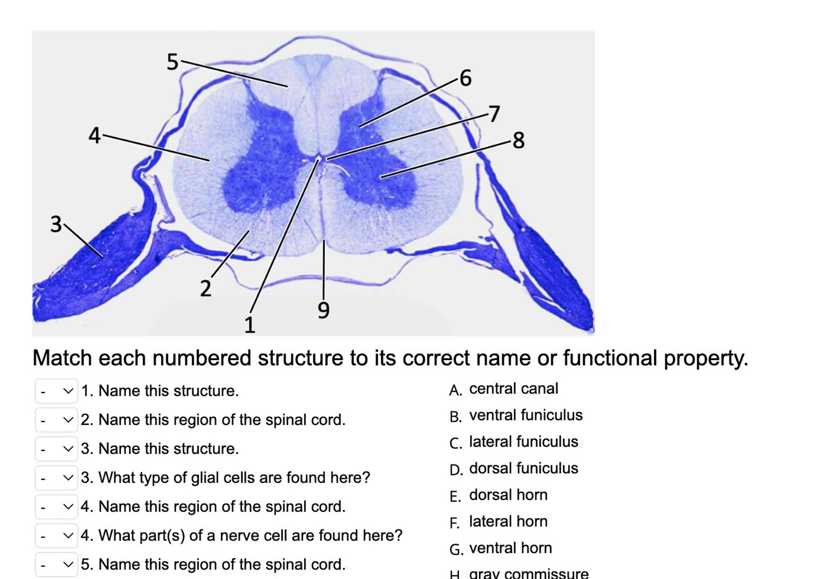 Solved match each numbered structure to its correct name or | Chegg.com