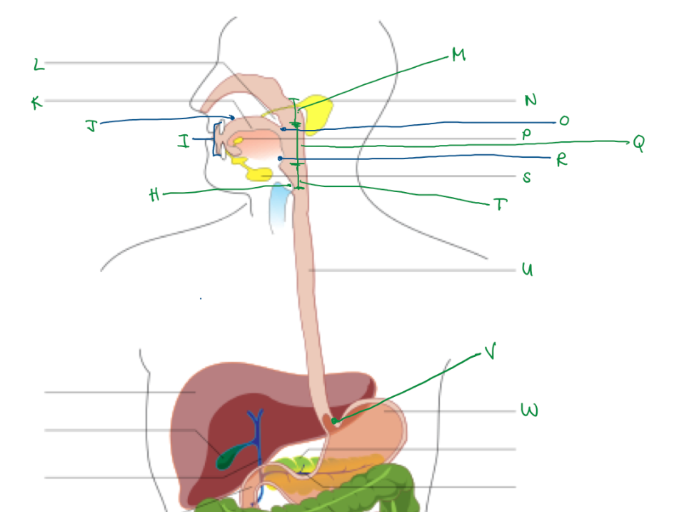 Solved Please help label. | Chegg.com