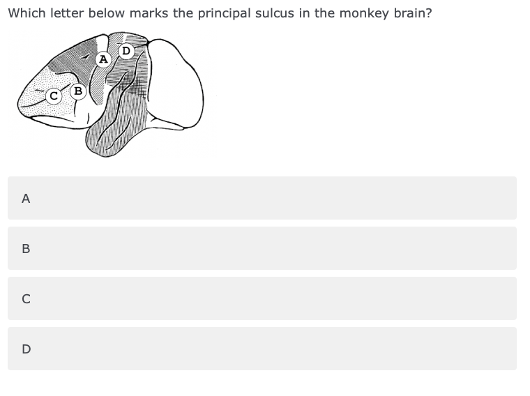 Solved Which letter below marks the principal sulcus in the | Chegg.com