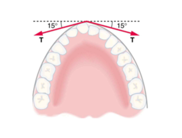 Solved Braces are used to apply forces to teeth to realign | Chegg.com
