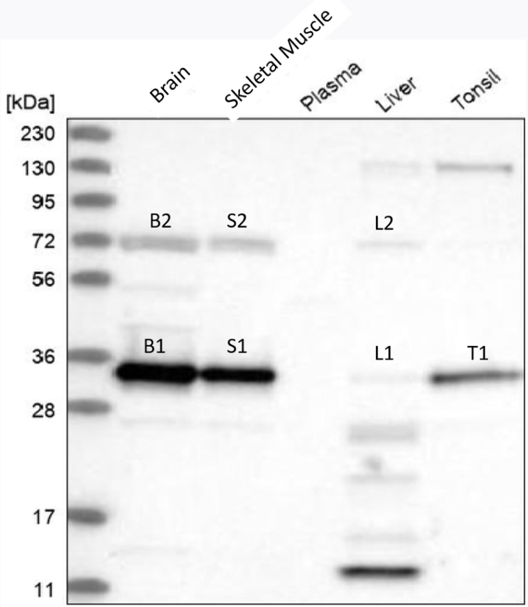 Solved The intensity of a band or signal indicates the | Chegg.com