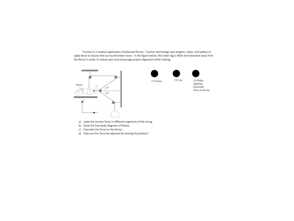Solved Traction is a medical application of balanced forces. | Chegg.com
