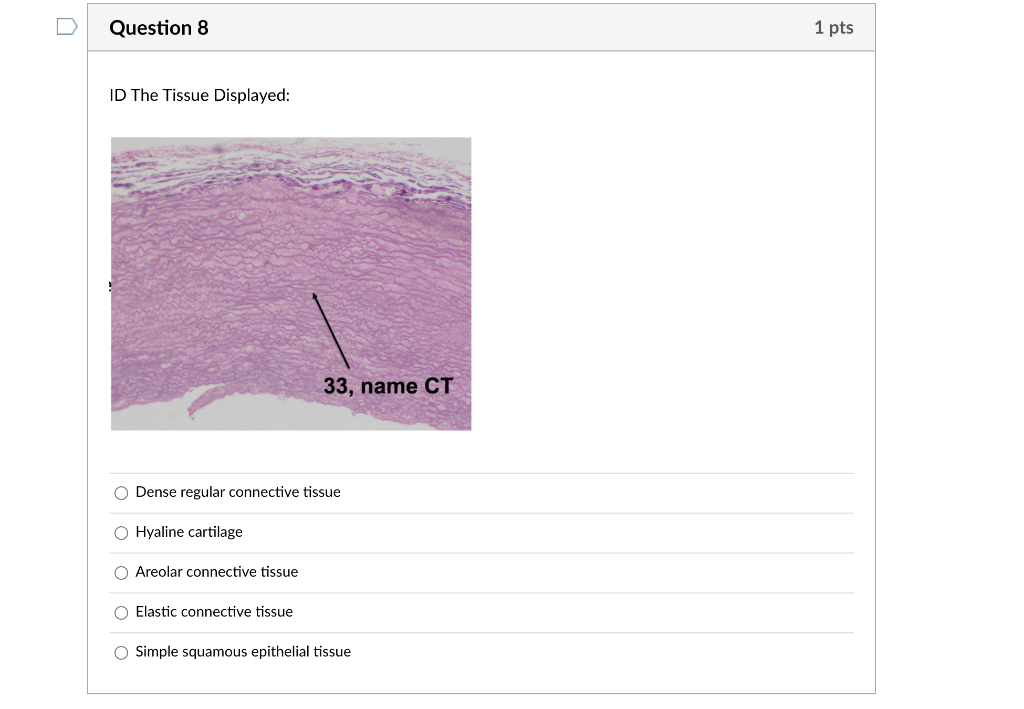 Solved Question 8 1 pts ID The Tissue Displayed: 33, name CT | Chegg.com
