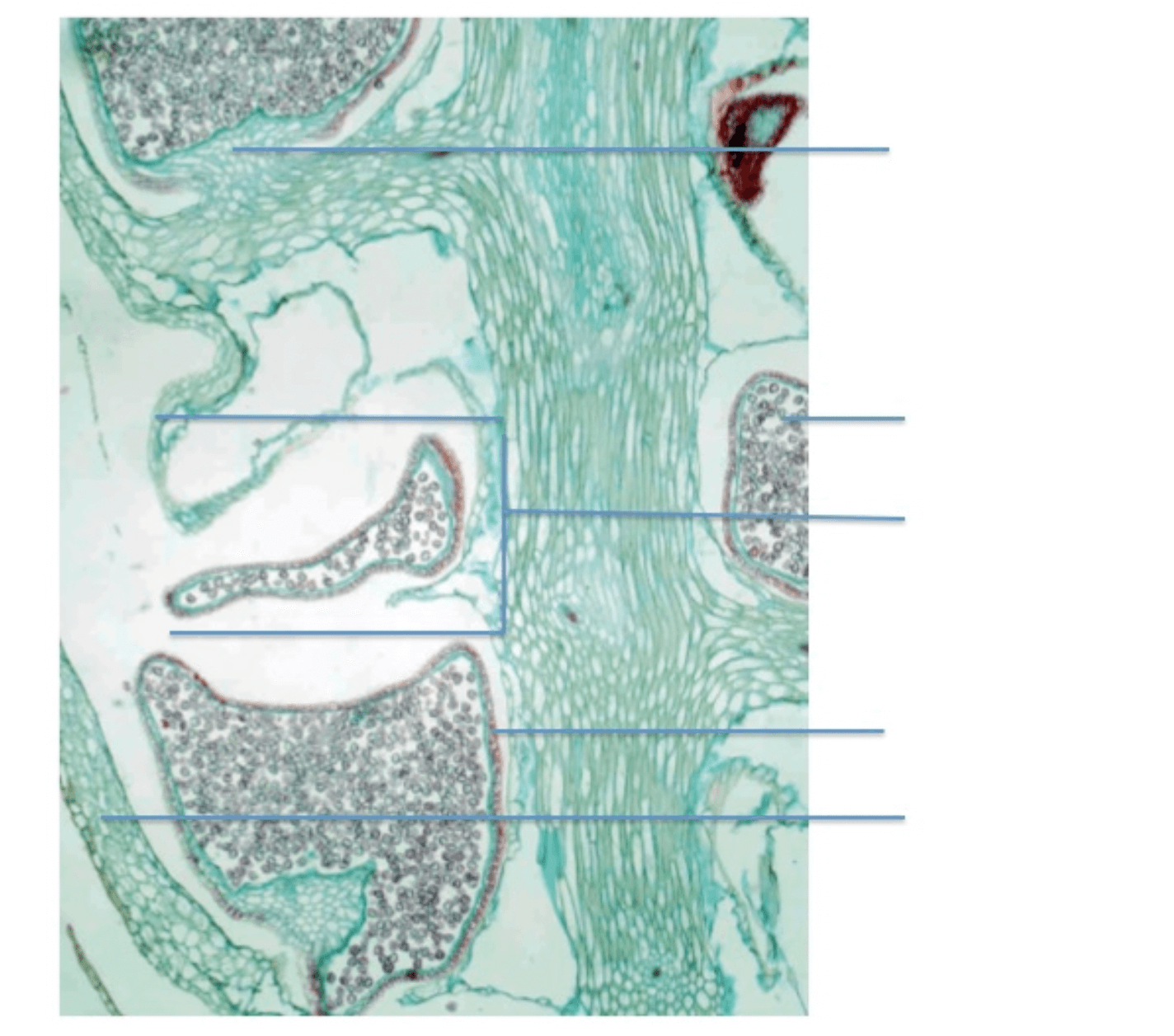Solved Attached is a photo of Lycopodium spp. strobilus | Chegg.com