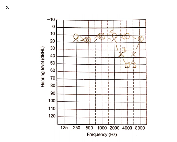 Solved Instructions: Interpret the audiograms below and | Chegg.com
