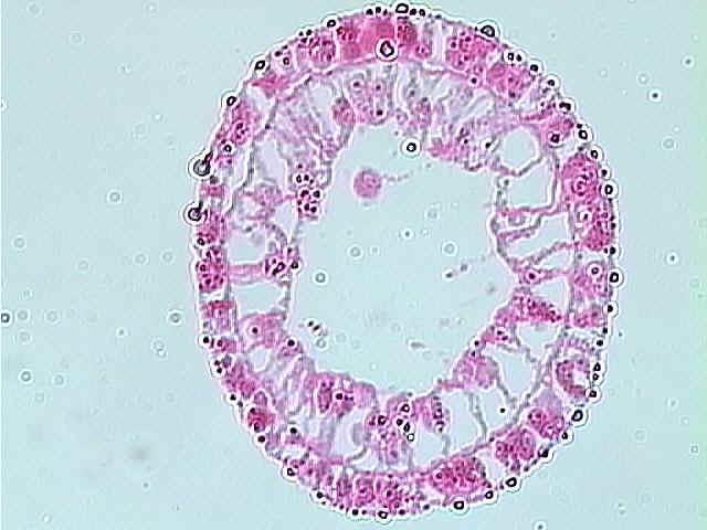 Hydra Cnidaria Cross Section