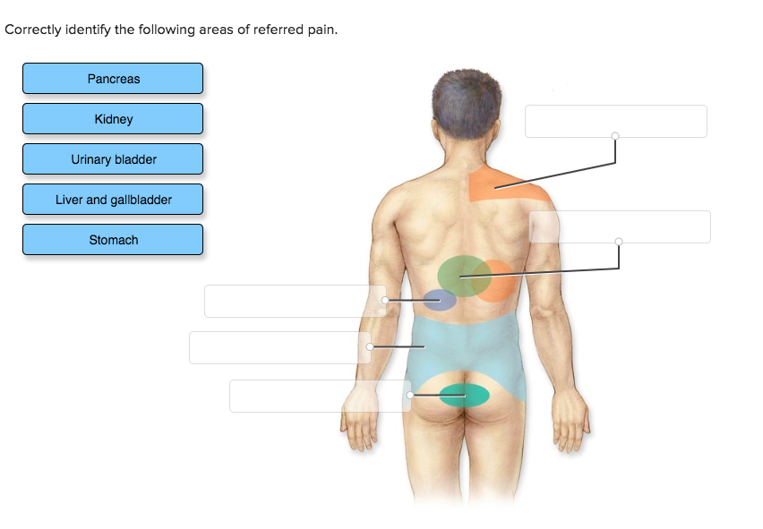 Solved Correctly identify the following areas of referred | Chegg.com