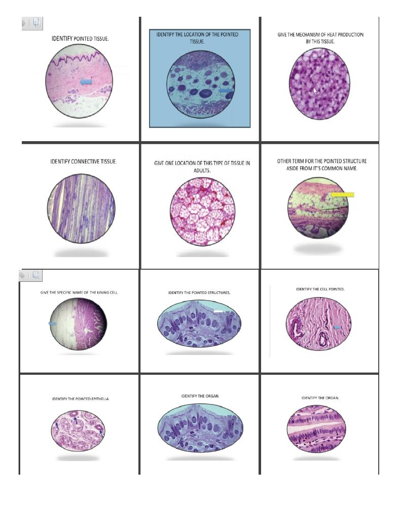 IDENTIFY POINTED TISSUE. IDENTIFY THE LOCATION OF THE | Chegg.com