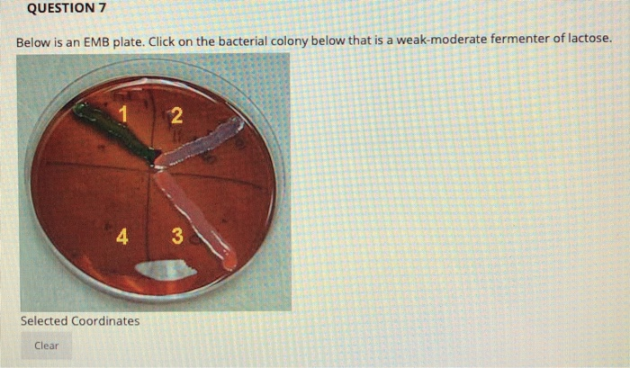 Solved QUESTION 7 Below is an EMB plate. Click on the | Chegg.com