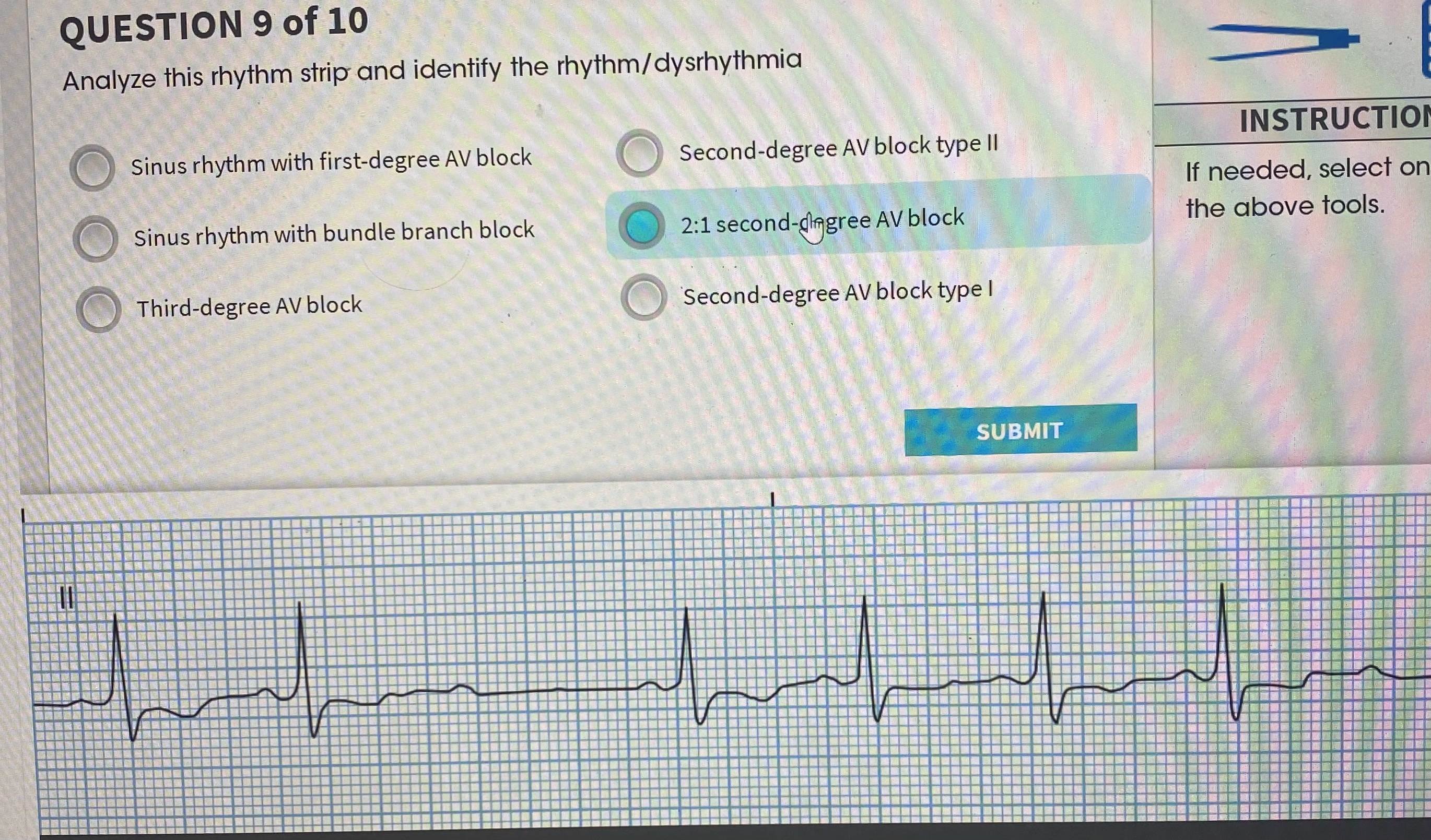 Solved Analyze this rhythm strip and identify the | Chegg.com