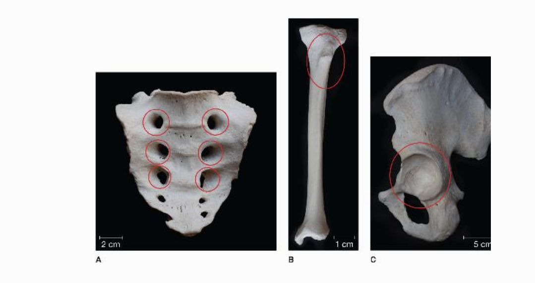 Solved sacrum, shine bone (tibia), ﻿pelvis (hip bone) | Chegg.com