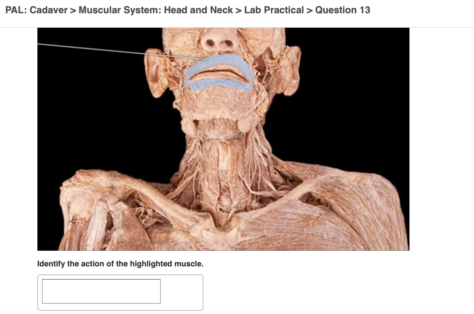 Solved PAL: Cadaver > Muscular System: Head and Neck > Lab | Chegg.com
