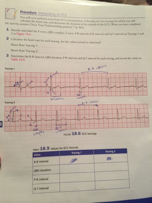 Solved You will now perform some basic ECG interpretation. | Chegg.com