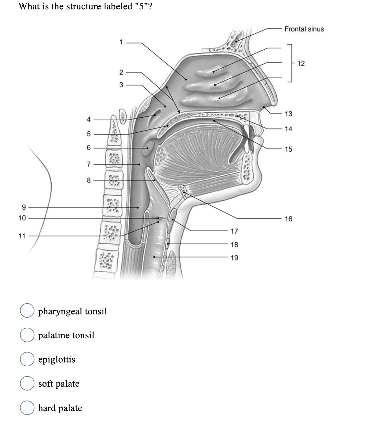 Solved What is the structure labeled "5"? pharyngeal tonsil | Chegg.com