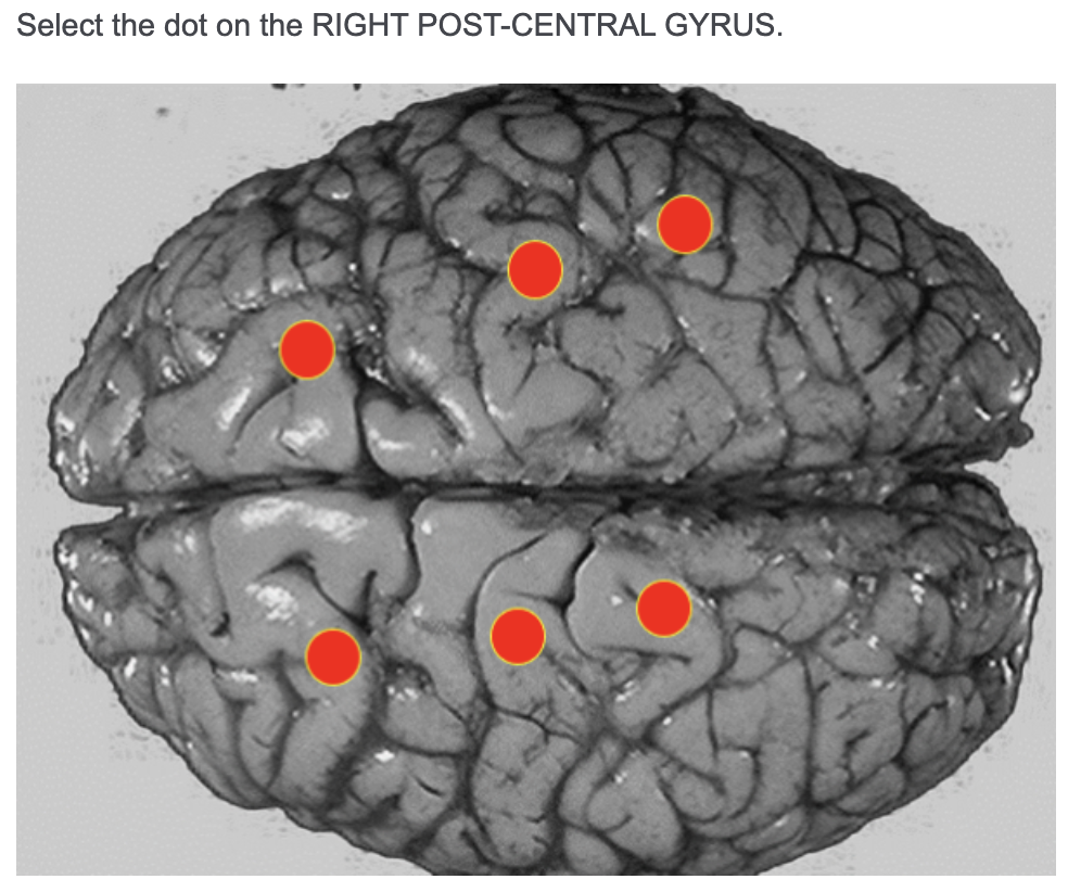 Solved Select the dot on the RIGHT POST-CENTRAL GYRUS. | Chegg.com
