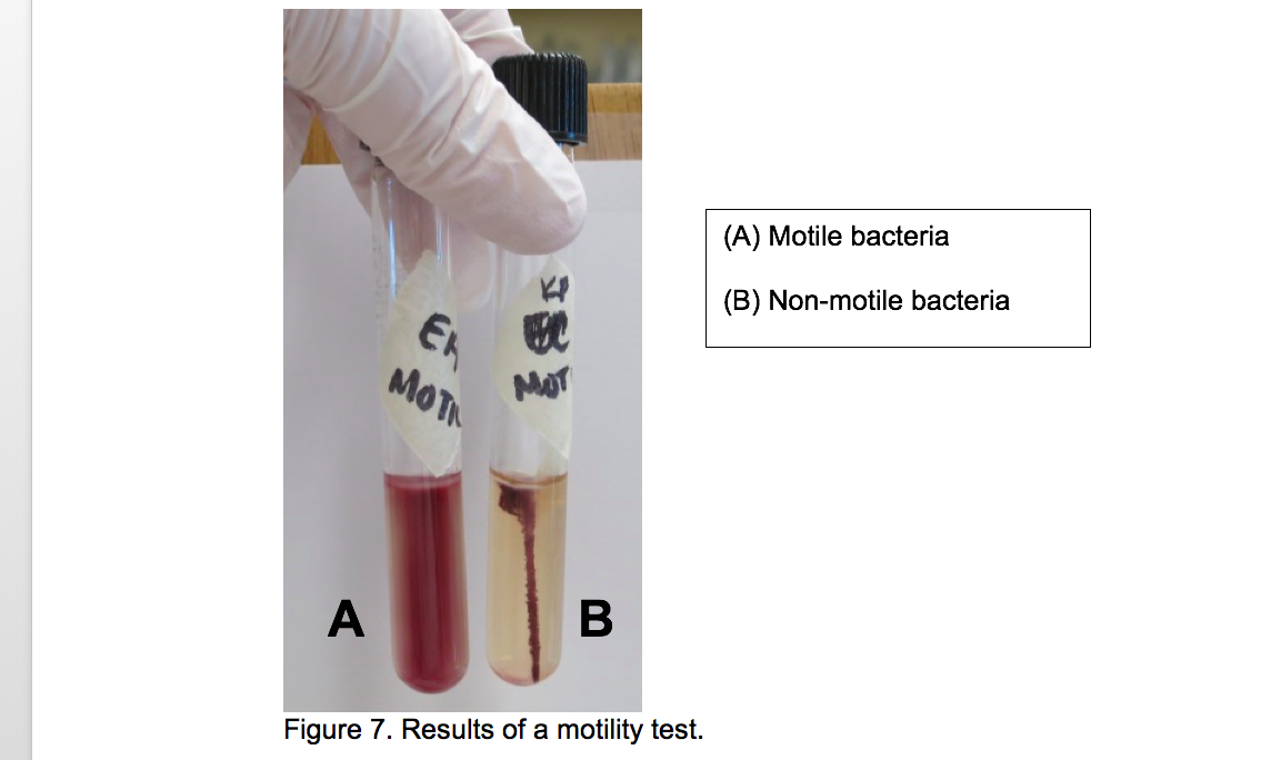 Solved (A) Motile bacteria (B) Non-motile bacteria ER MOTN | Chegg.com
