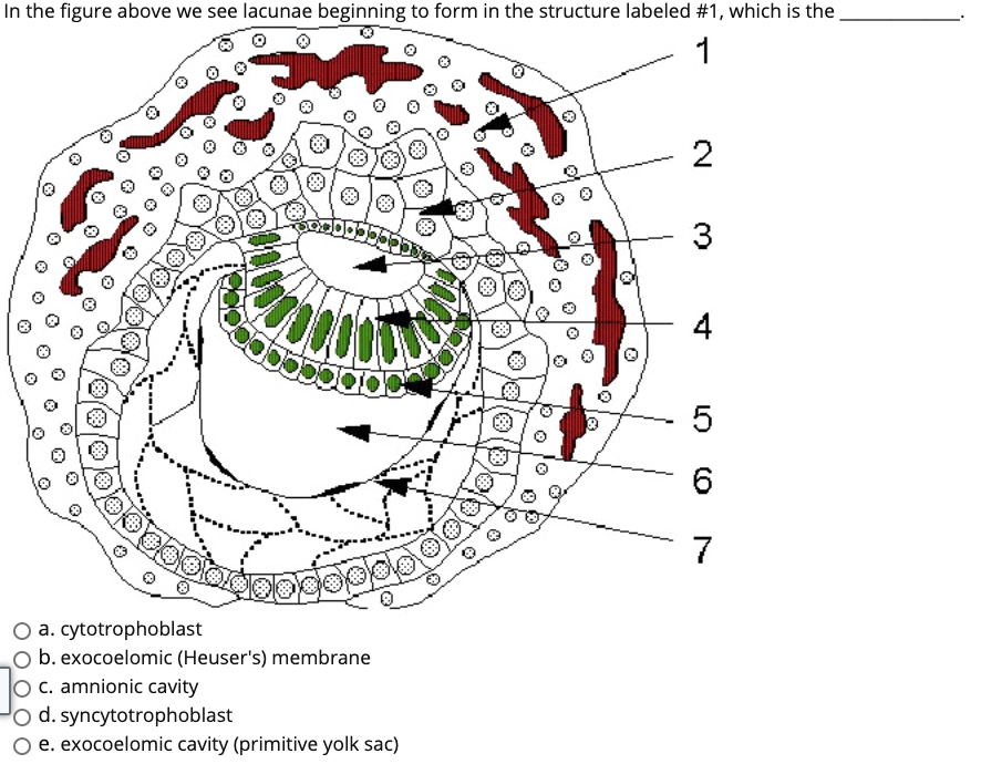 Solved in the figure above we see lacunae beginning to form | Chegg.com