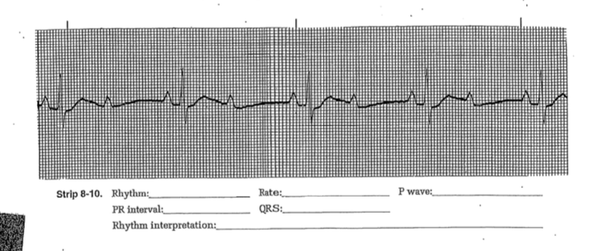 Solved Atrial Rhythm Packet: 8.10 Rhythm: (regular or | Chegg.com