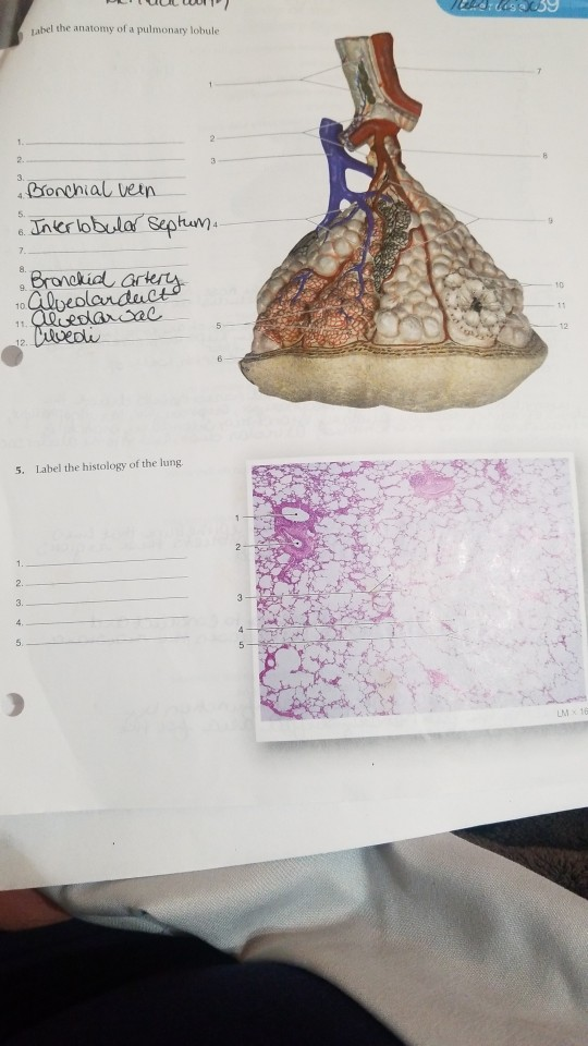 Solved Label the anatomy of a pulmonary lobule 2. 3. onohid | Chegg.com