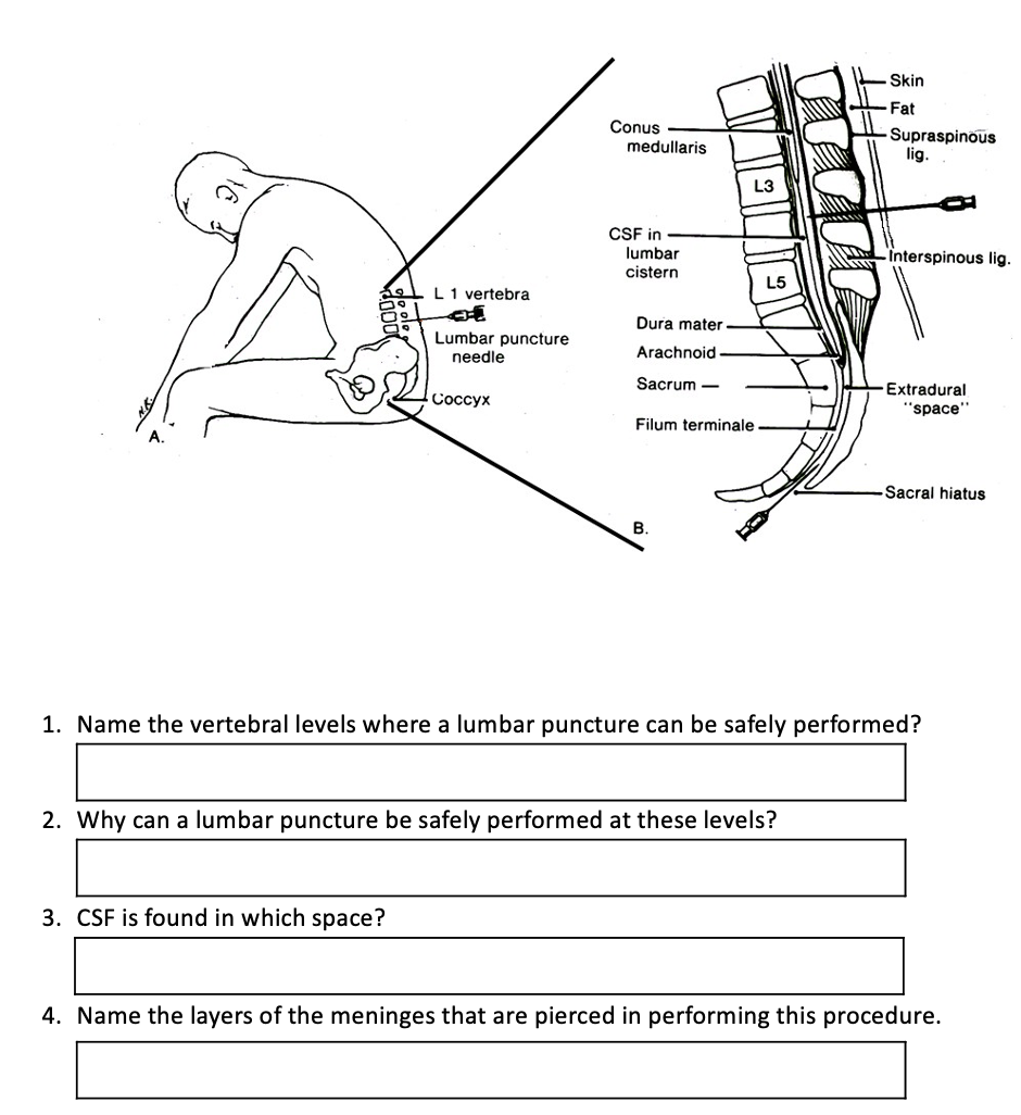 Lumbar Puncture Layers