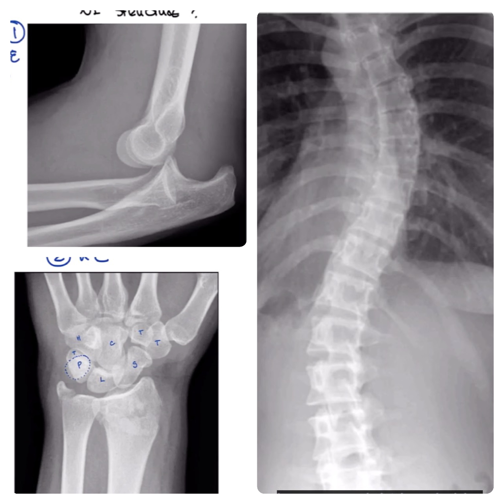 Solved Identify and describe the each presented X-ray in | Chegg.com