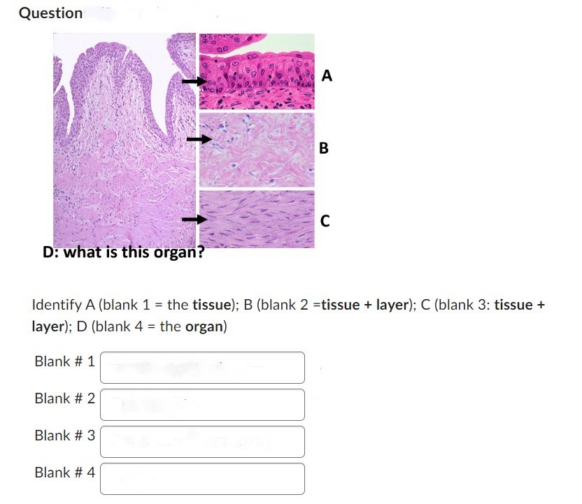 Solved Question Identify A (blank 1 = the tissue); B (blank | Chegg.com